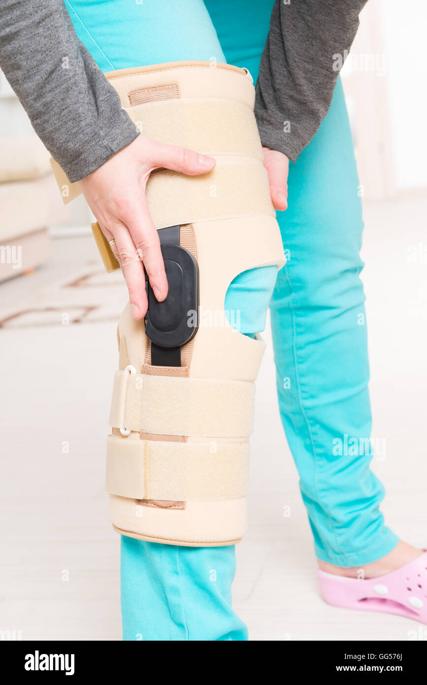 Woman's leg in knee cages for stabilization and support Stock Photo - Alamy