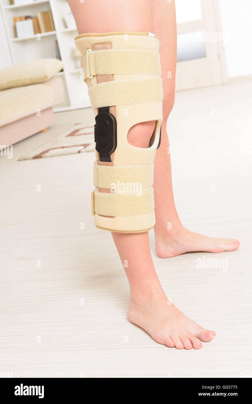 Woman's leg in knee cages for stabilization and support Stock Photo - Alamy