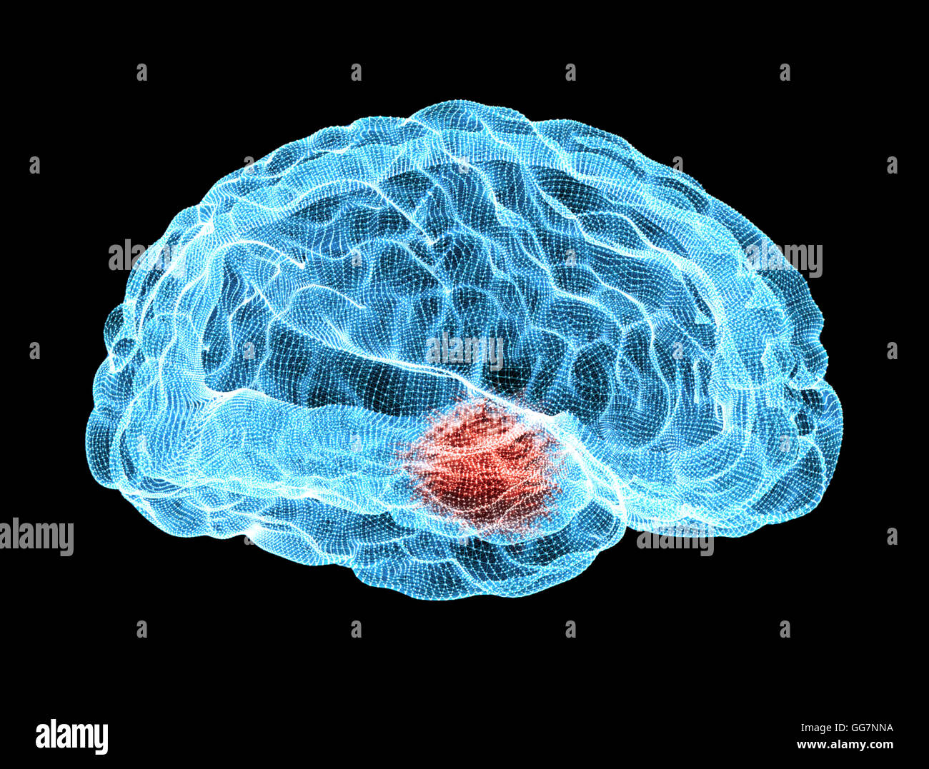 Brain degenerative diseases, Parkinson Stock Photo - Alamy