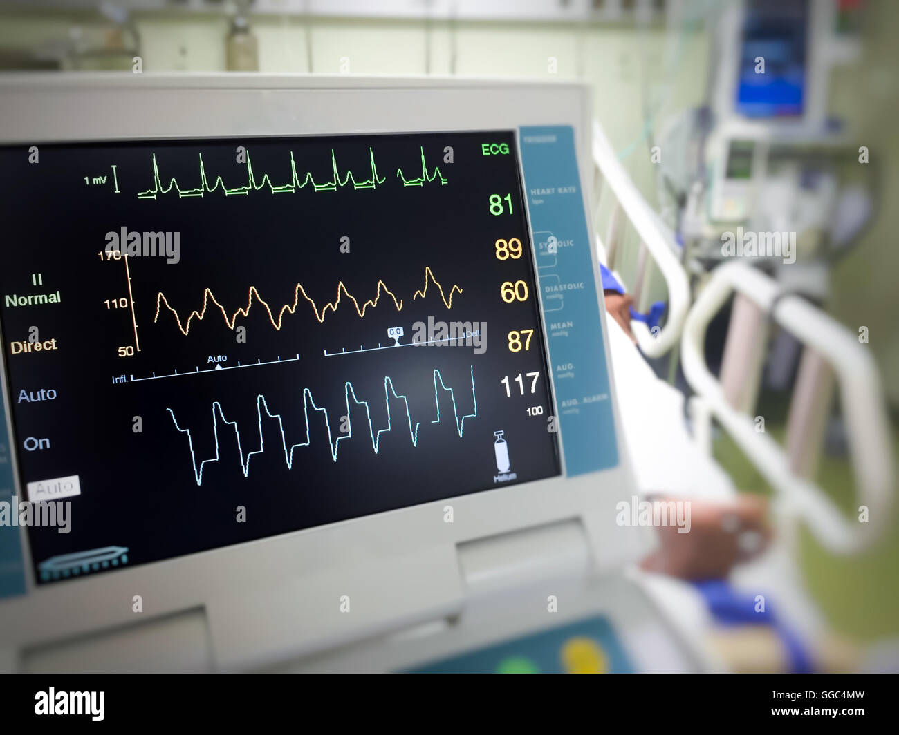 Close up EKG monitor in icu room Stock Photo - Alamy