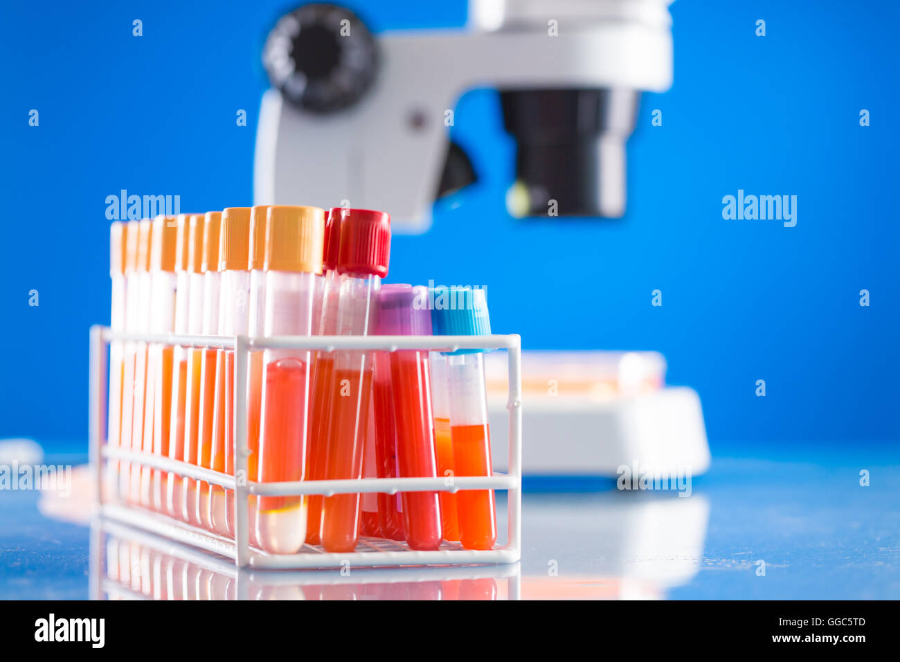 rack with test tubes . blood sample and microscope in laboratory Stock ...