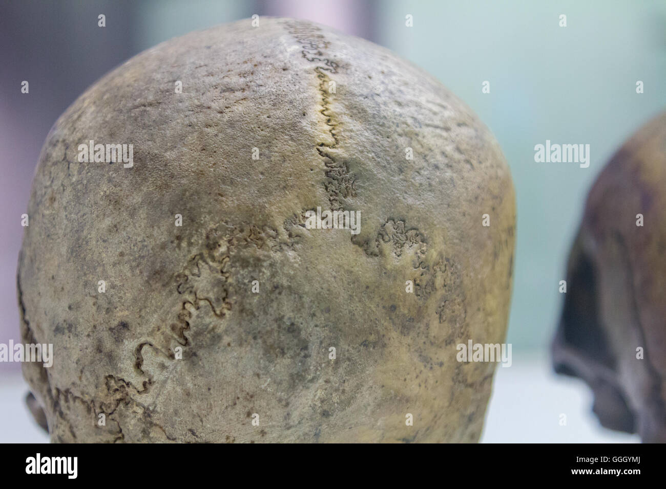 Back of a human skull Stock Photo - Alamy