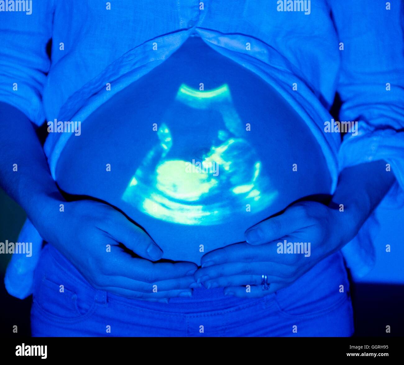Pregnant woman with baby scan on tummy Stock Photo - Alamy