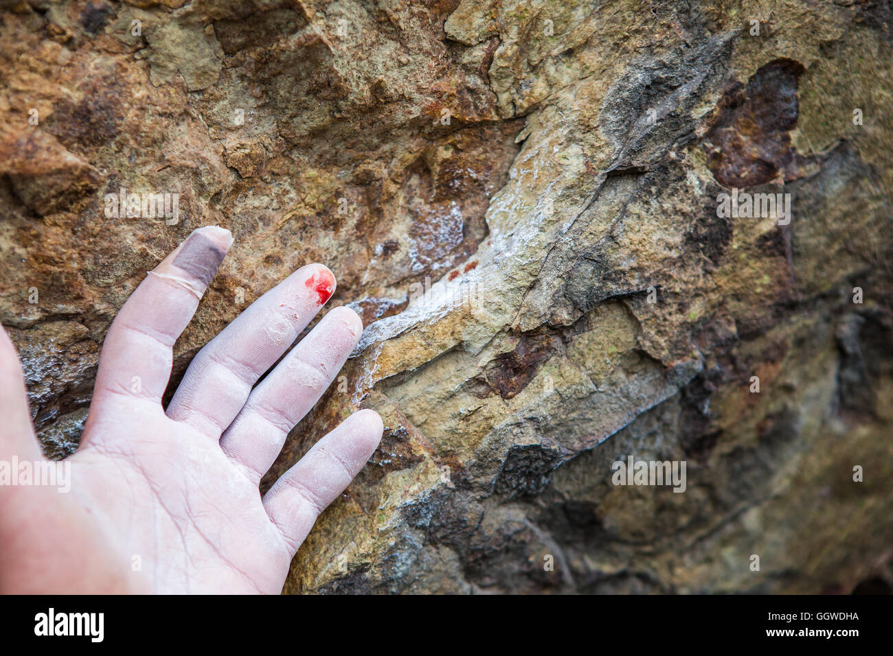 Hand injured finger icon hi-res stock photography and images - Alamy