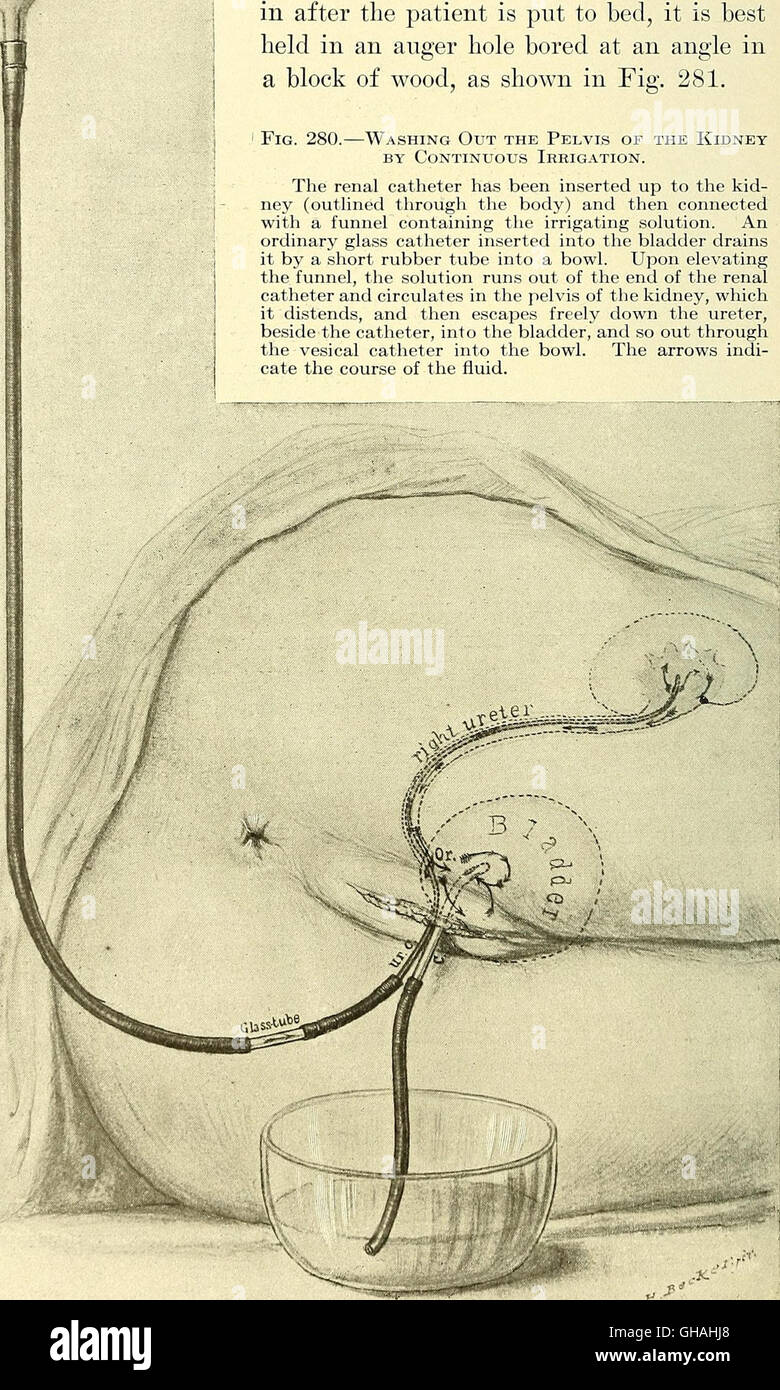*Operative Gynecology* (1906) is a medical textbook that focuses on the ...