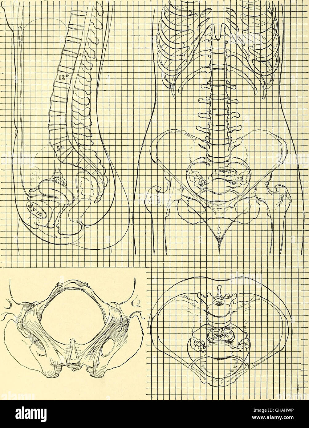 Published in 1906, this work on operative gynecology covers surgical ...