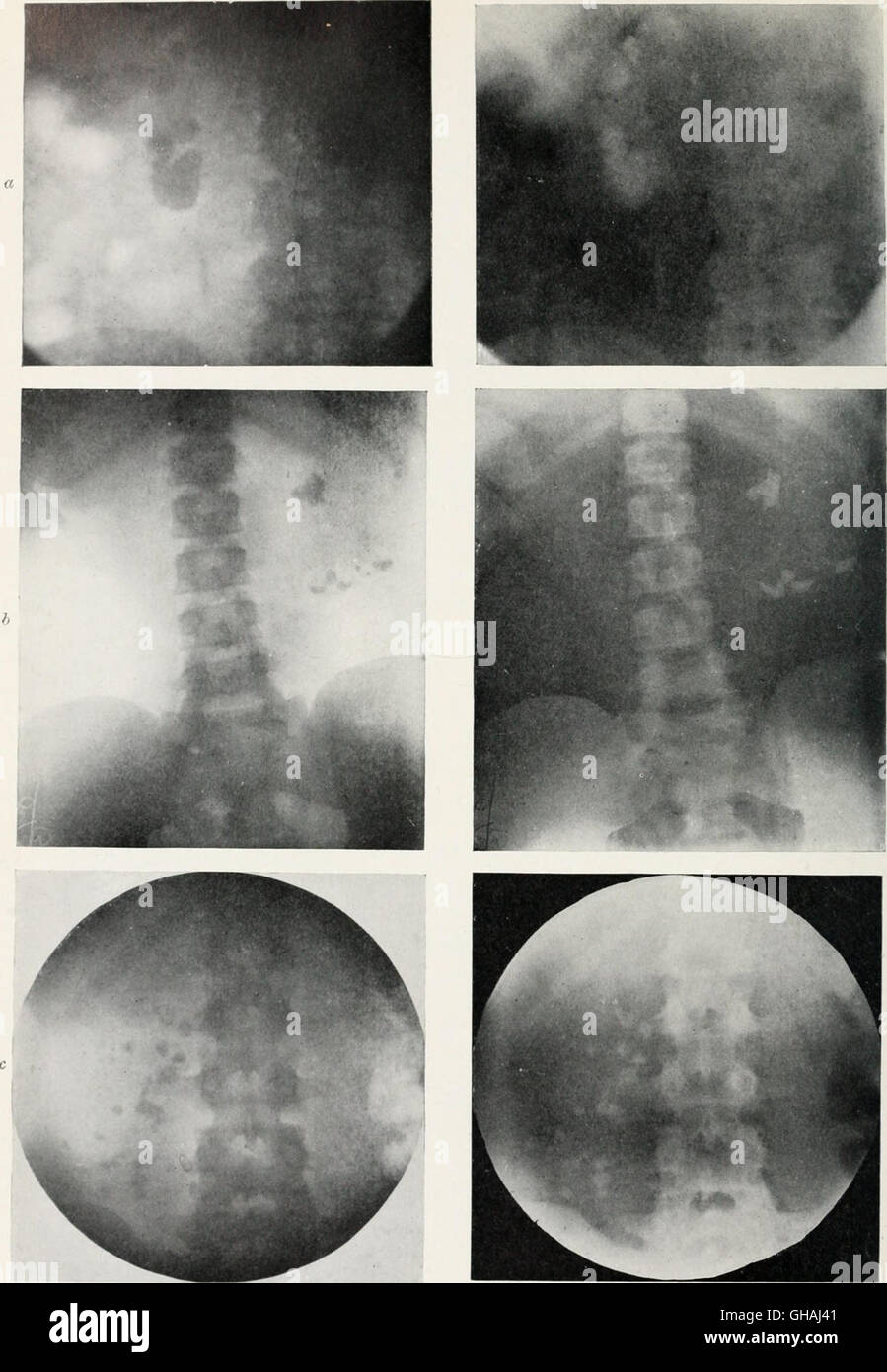 Radiography, X-ray therapeutics and radium therapy (1916 Stock Photo ...