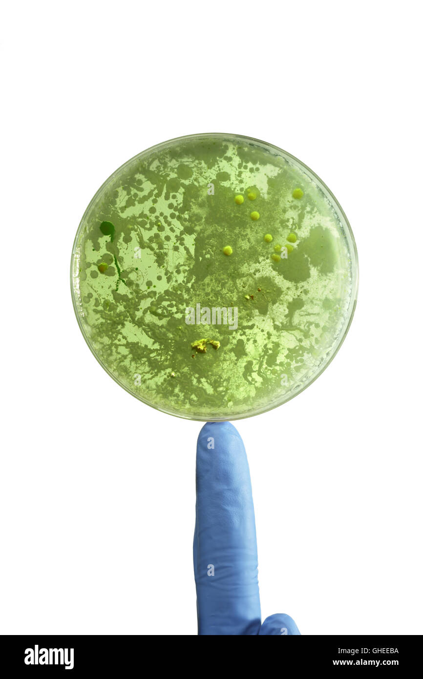Bacteria growing in a petri dish balanced on a finger Stock Photo - Alamy