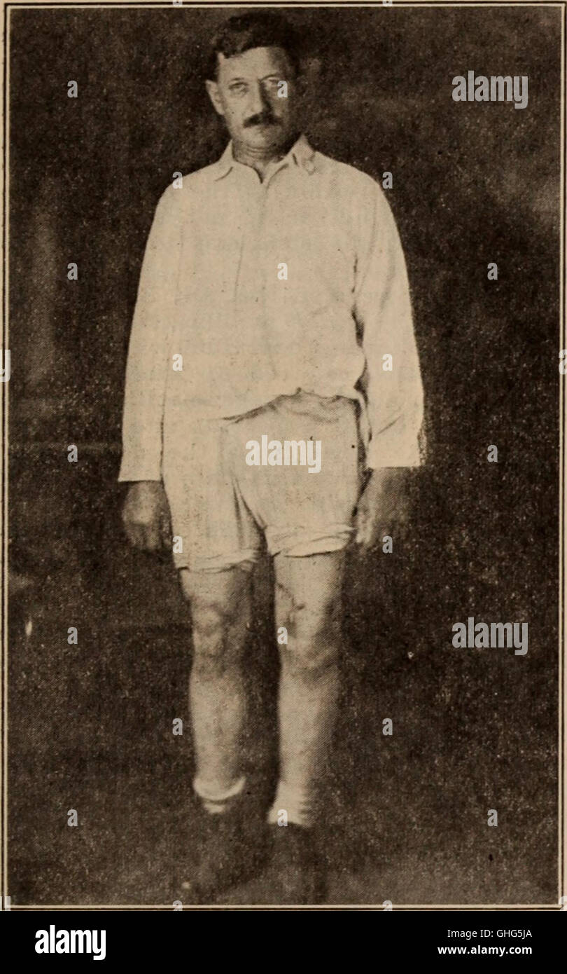 A 1920 medical journal providing updates, research, and clinical ...