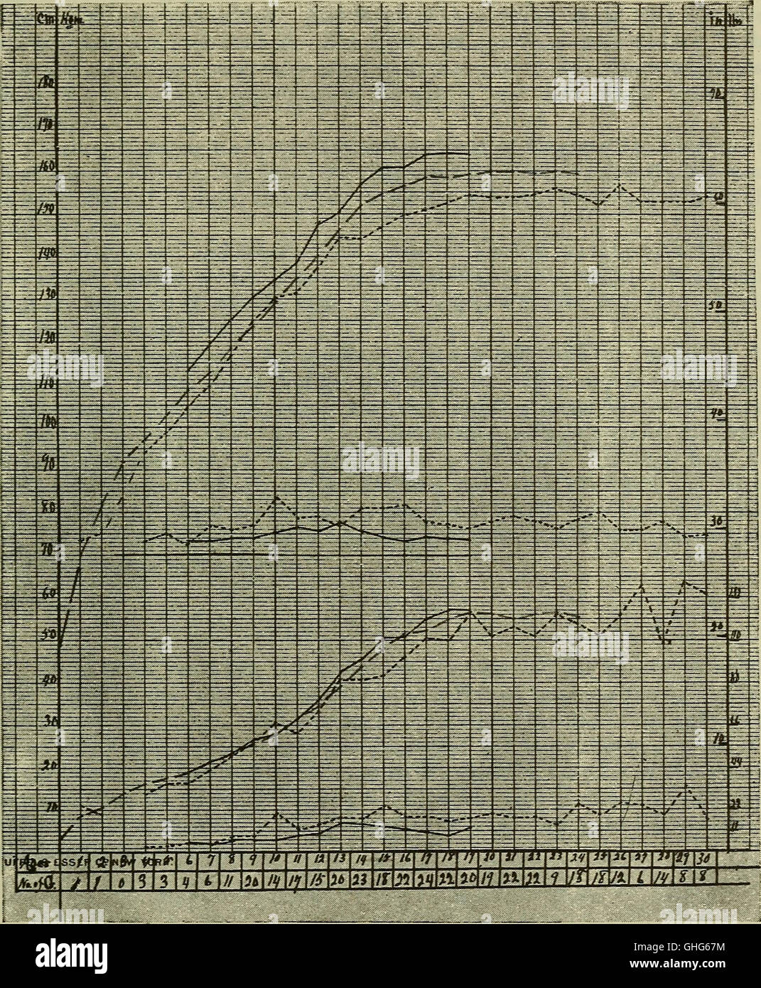 Psycho asthenics hi-res stock photography and images - Alamy
