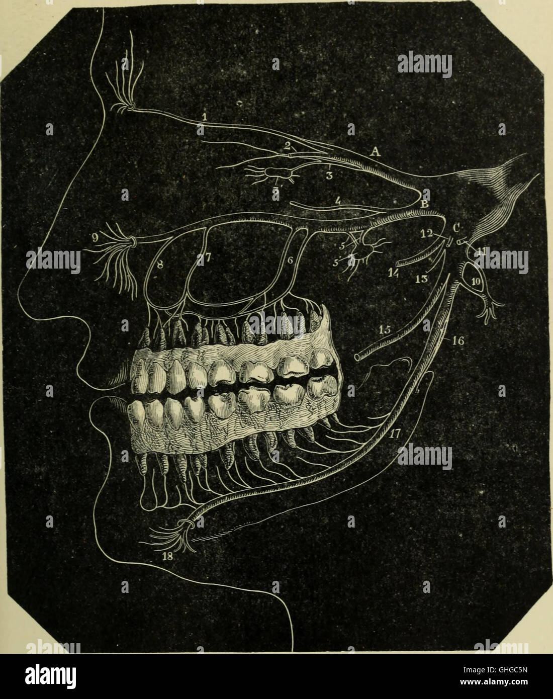 Dental pathology drawing hi-res stock photography and images - Alamy