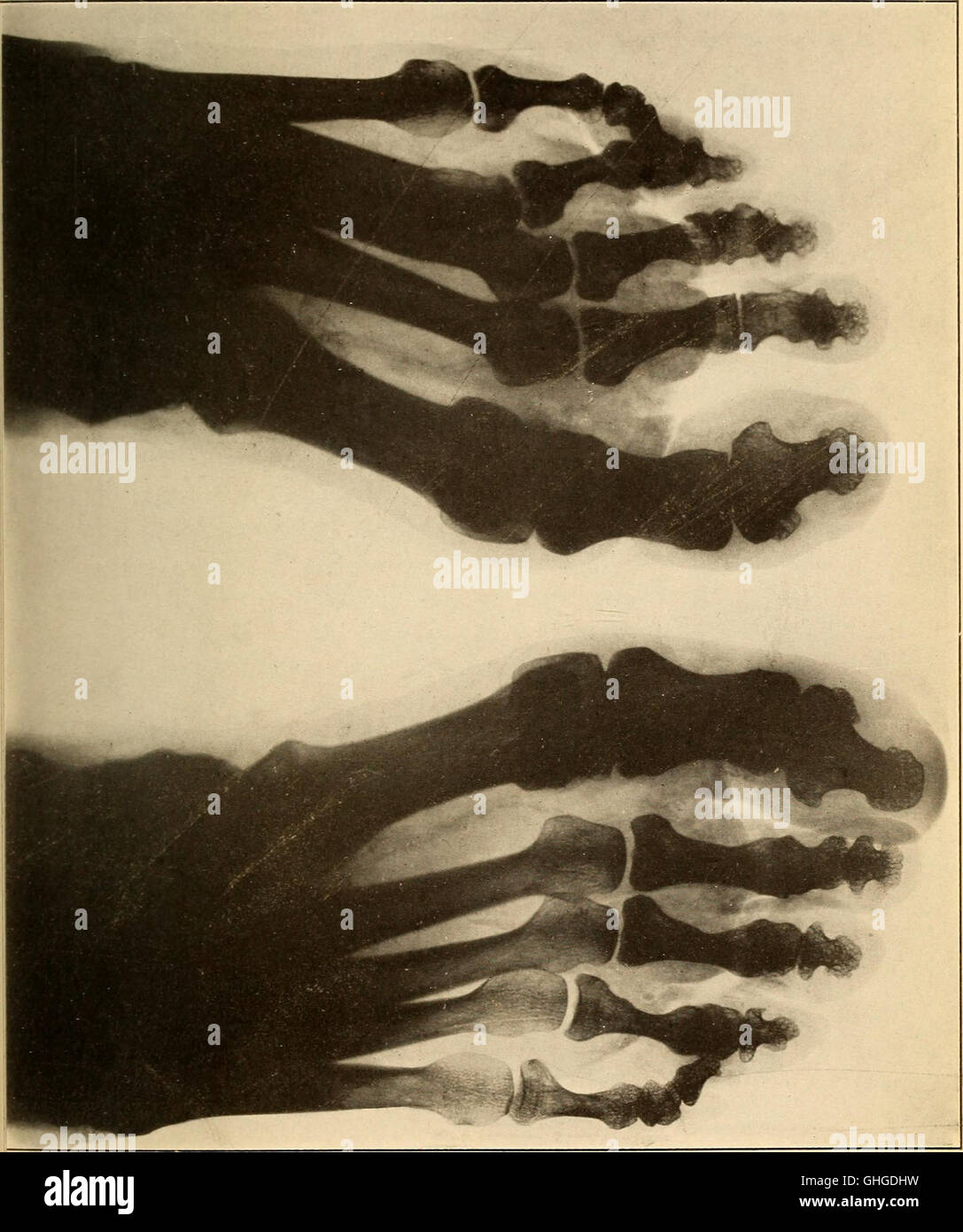 This 1914 work discusses the diseases associated with old age, focusing ...