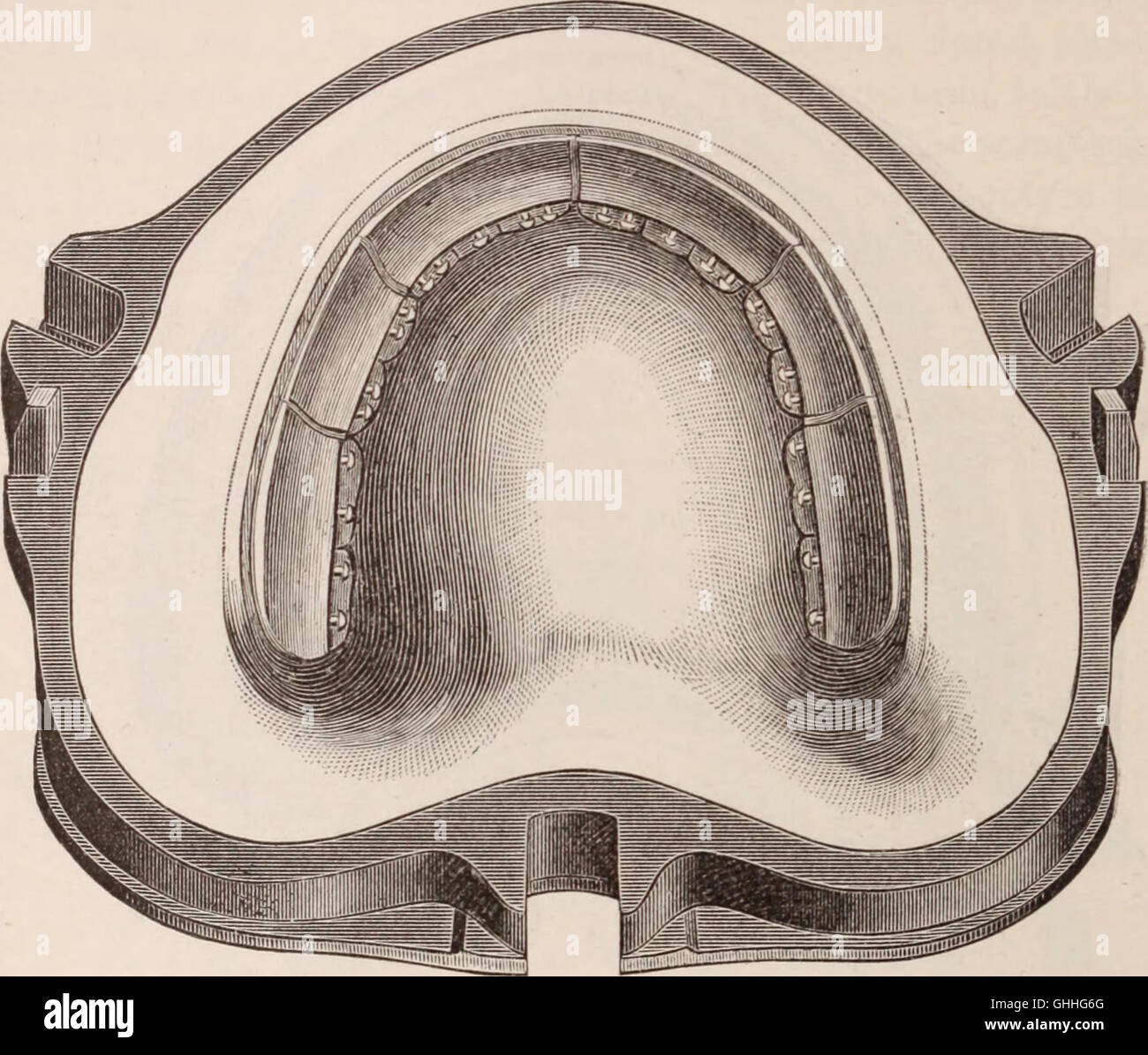 This instructional guide on denture making provides step-by-step ...
