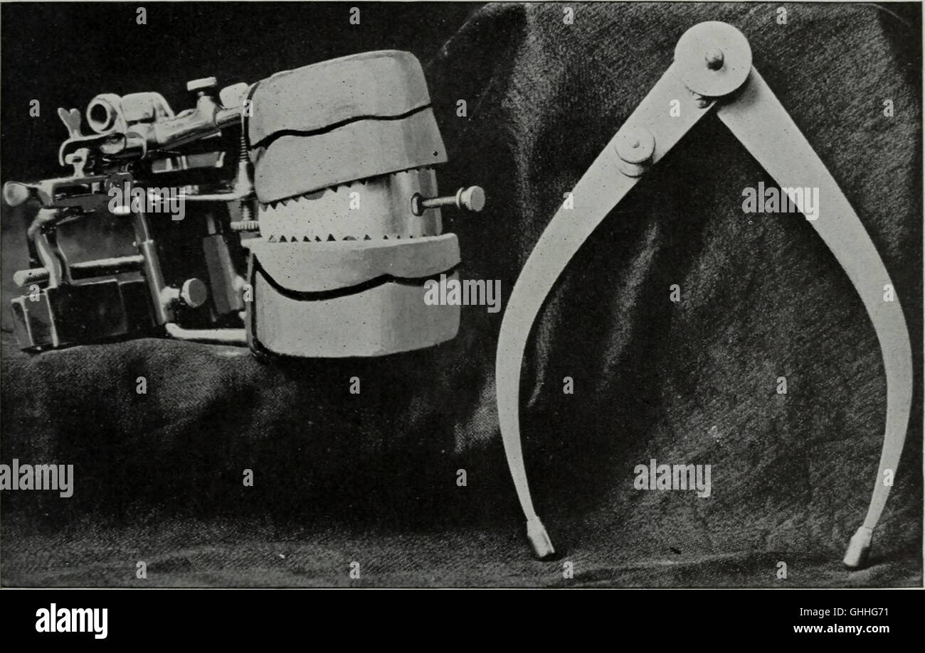 This device, known as a bite-gage, is used in dentistry to measure and ...