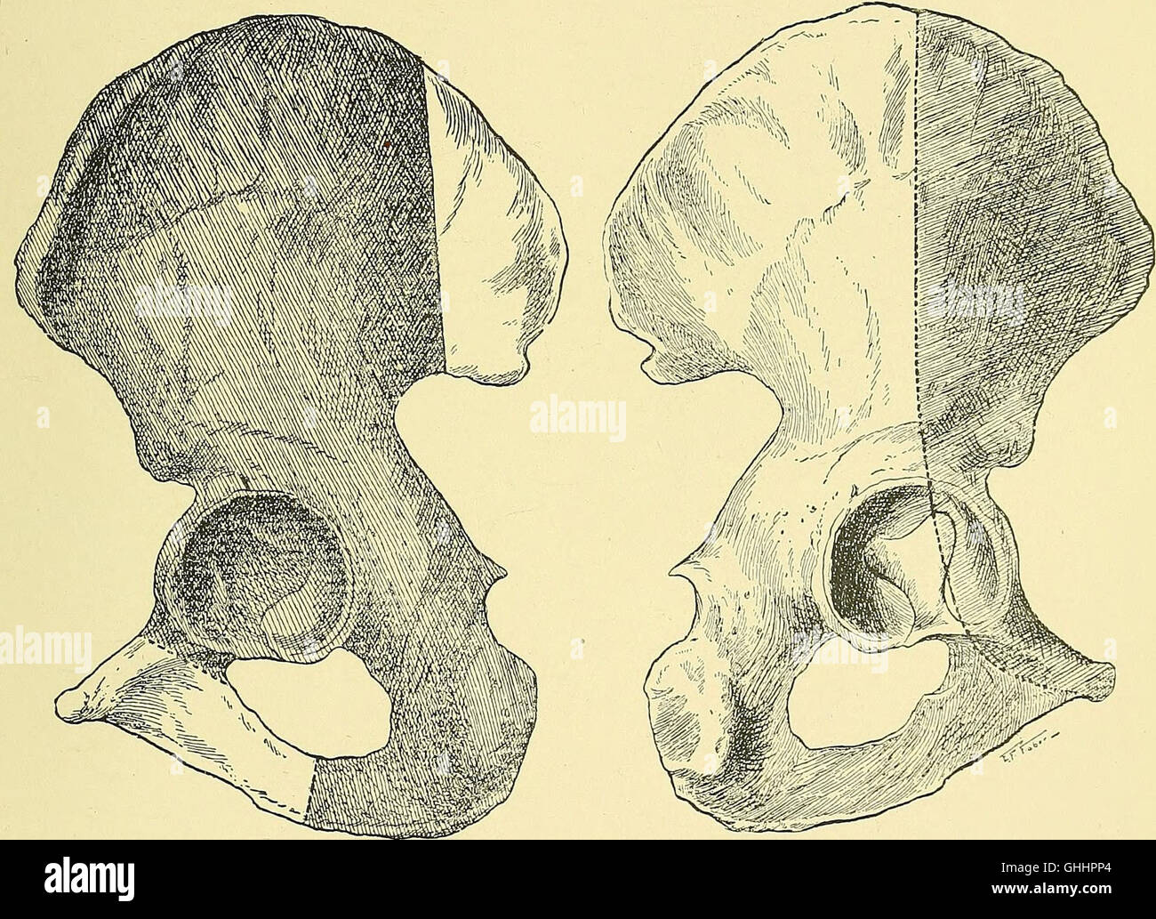 This 1911 textbook provides a comprehensive guide to operative surgery ...