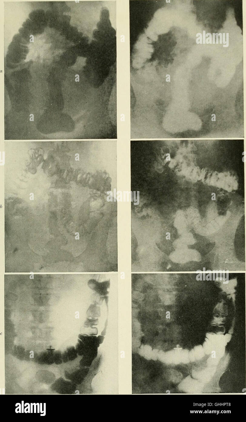 This 1915 publication covers the application of radiography, x-ray ...