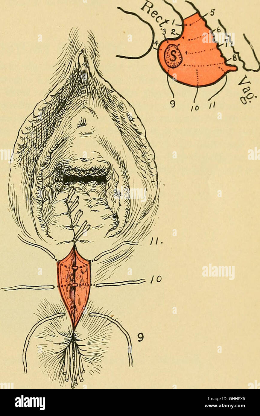 *The Practice of Obstetrics* (1910) is a medical textbook focused on ...