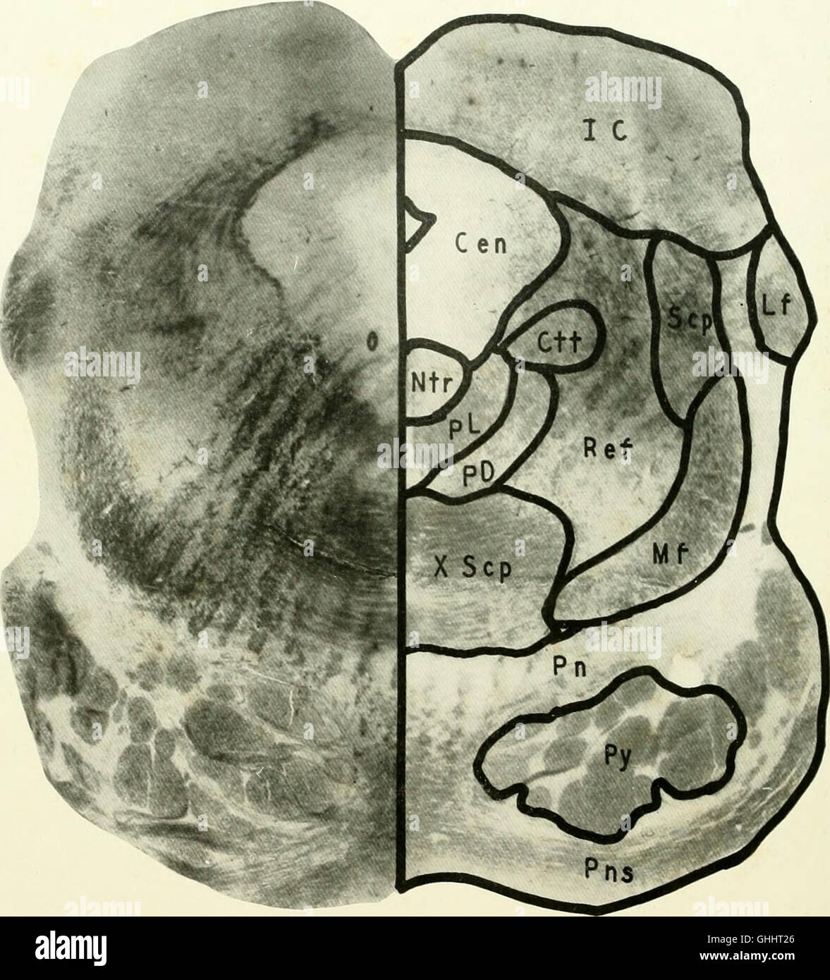 This 1928 work traces the evolution of the human brain from early ...