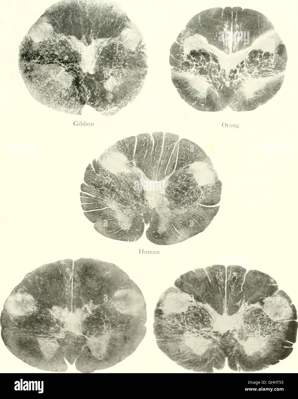 This 1928 work examines the evolution of the human brain, comparing the ...