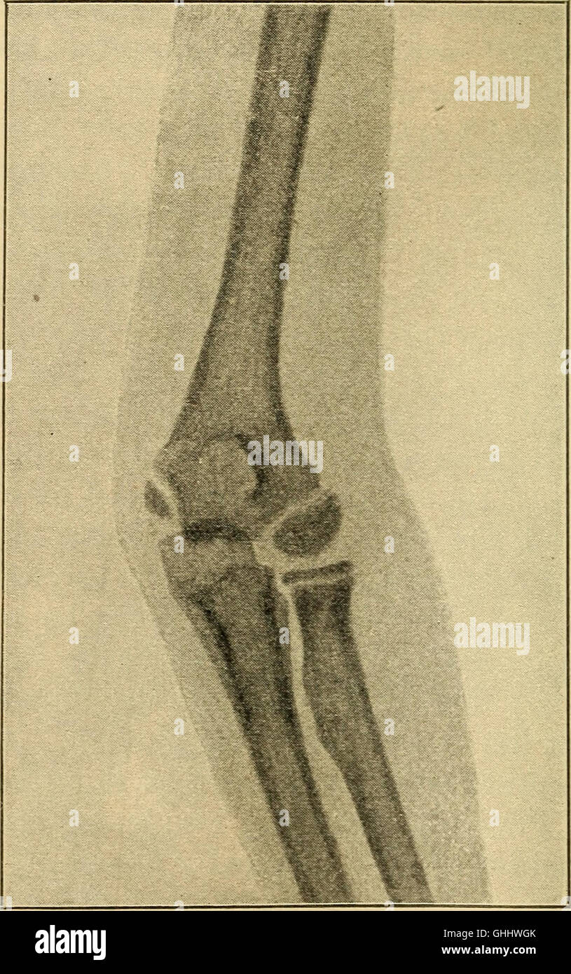 The *Atlas and Epitome of Traumatic* (1902) provides detailed ...