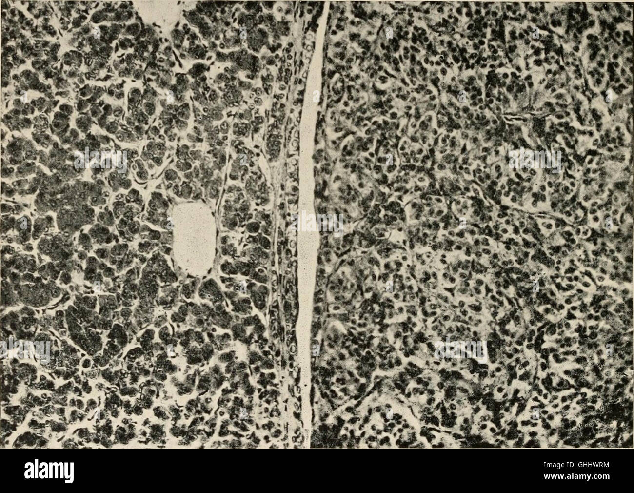 Internal secretion hi-res stock photography and images - Alamy