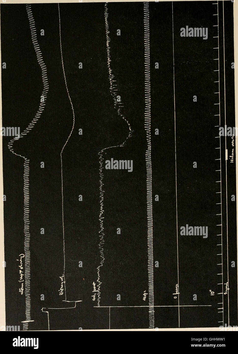 Secretion organs hi-res stock photography and images - Alamy