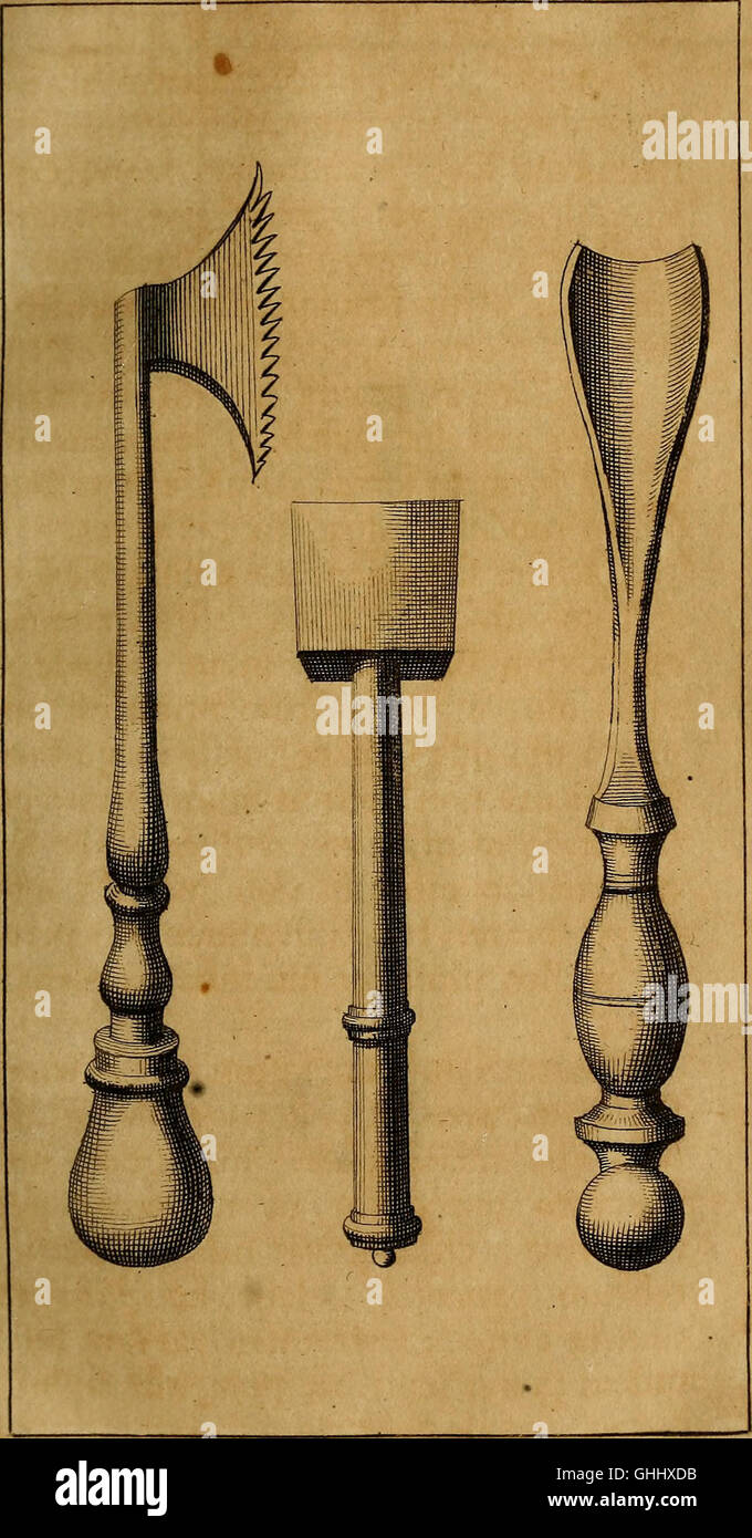 This 1715 medical text by Jacobi Berengarii Carpensis is a detailed ...