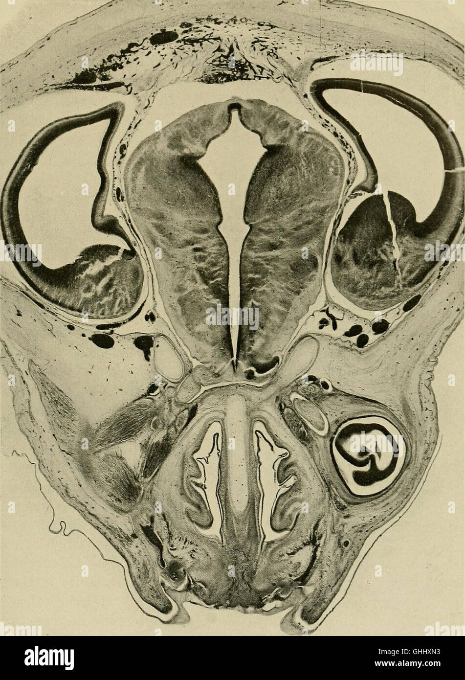 A 1904 German scientific study on the development of the human brain ...