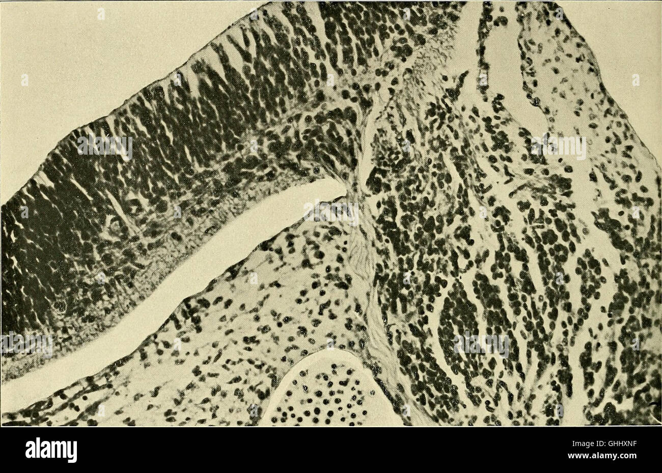 This 1904 study examines the development of the human brain during the ...