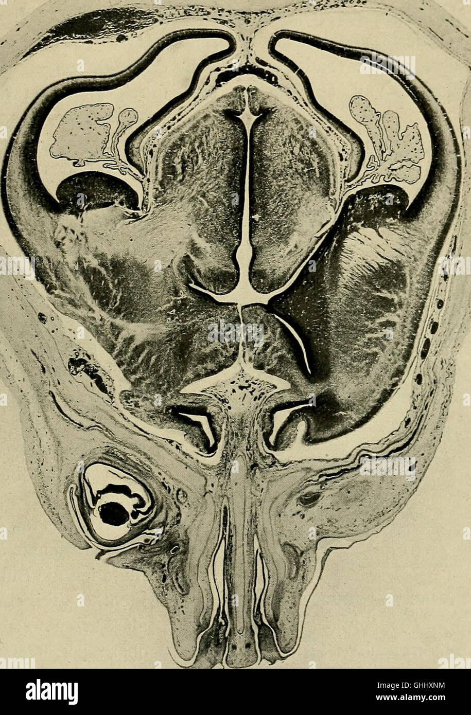 This 1904 study, titled 'The Development of the Human Brain During the ...