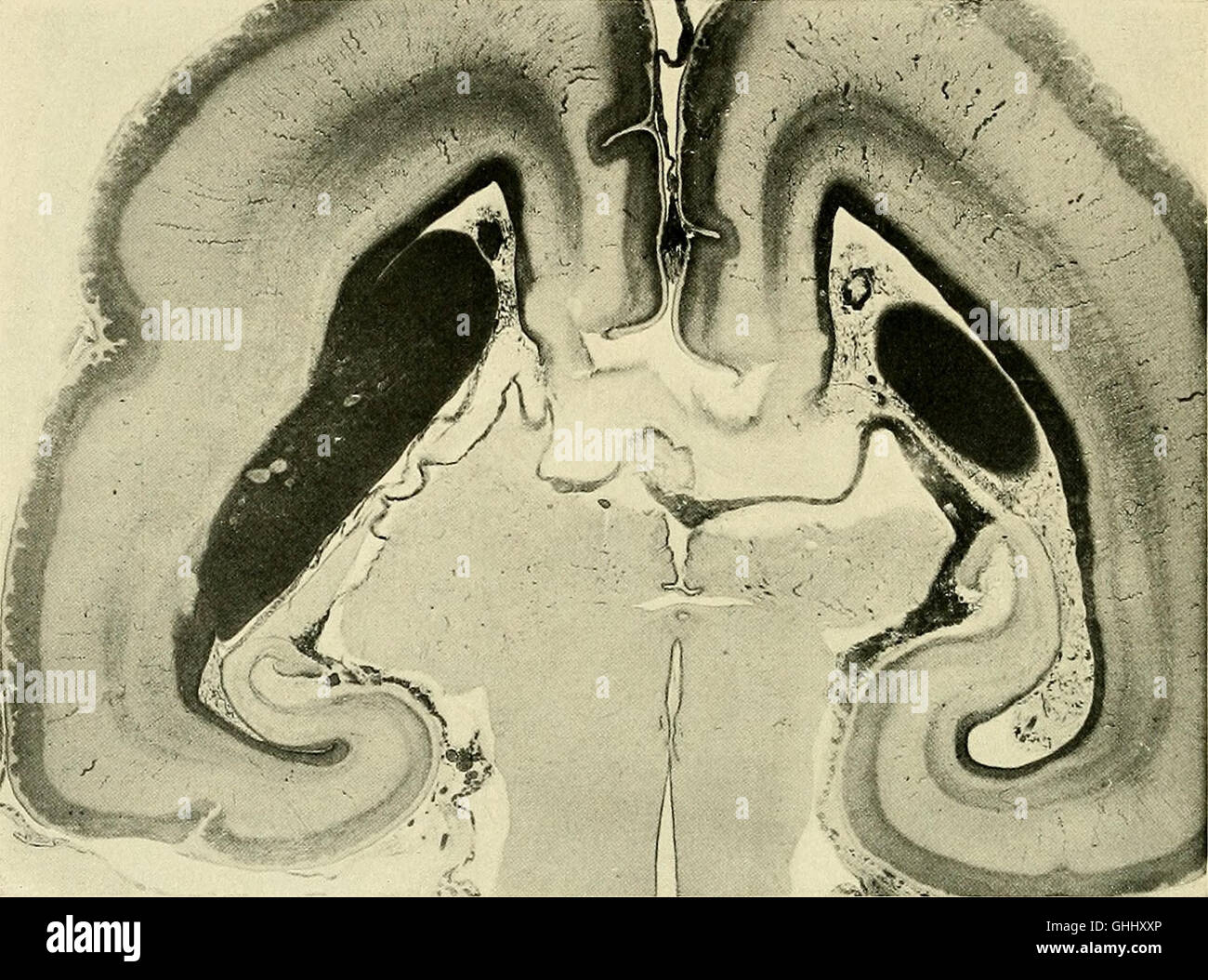 This 1904 German study investigates the development of the human brain ...