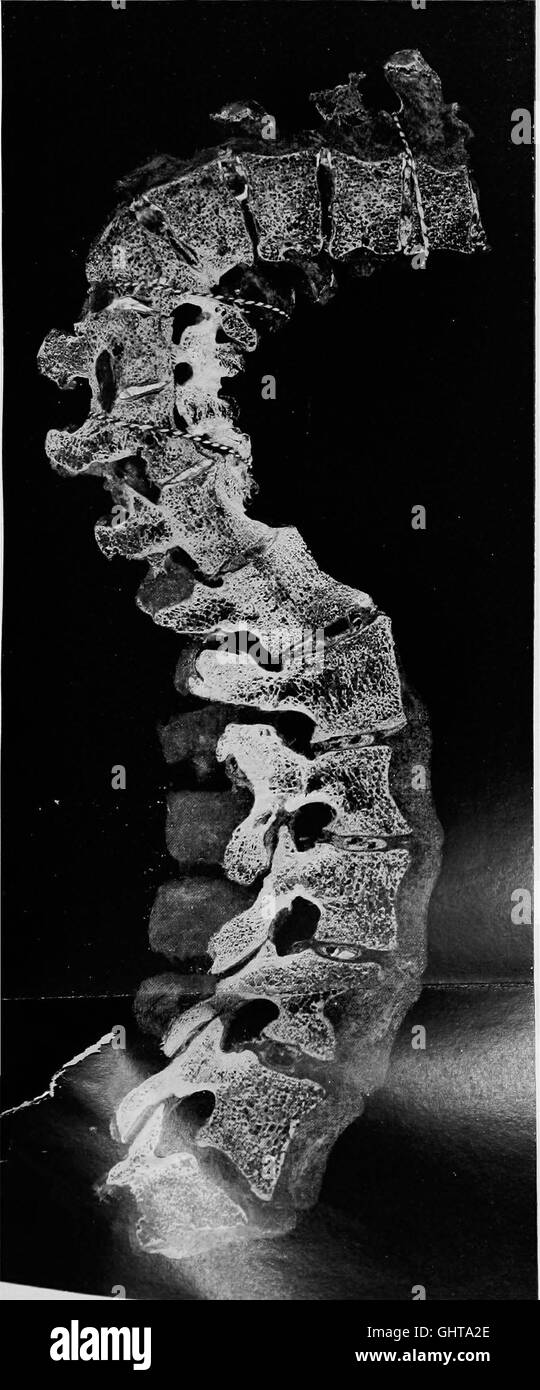 'On Bone Formation' (1920) explores the relationship between bone ...
