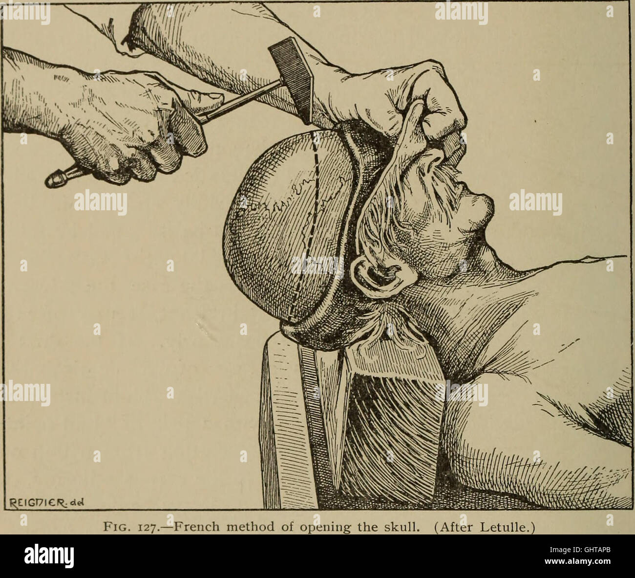 This manual on post-mortem pathology provides detailed instructions on ...