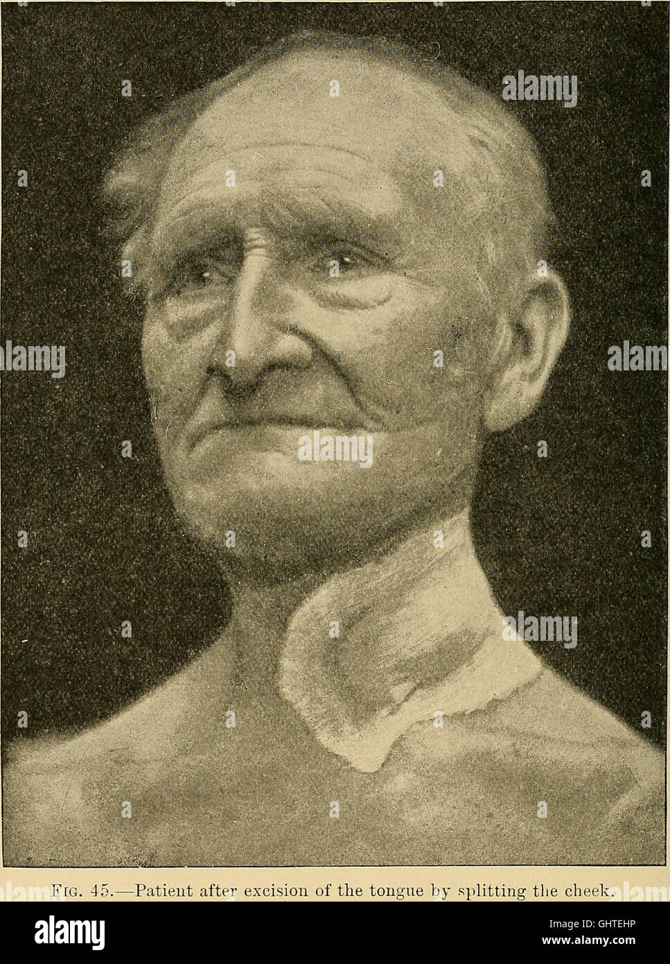 The 'Text-Book of Operative Surgery' (1903) is a comprehensive guide ...