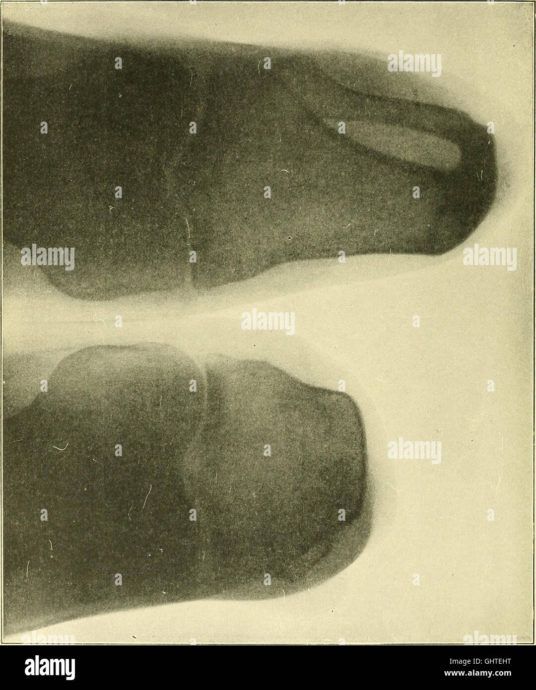 *Text-book of Operative Surgery* (1911) provides detailed instructions ...