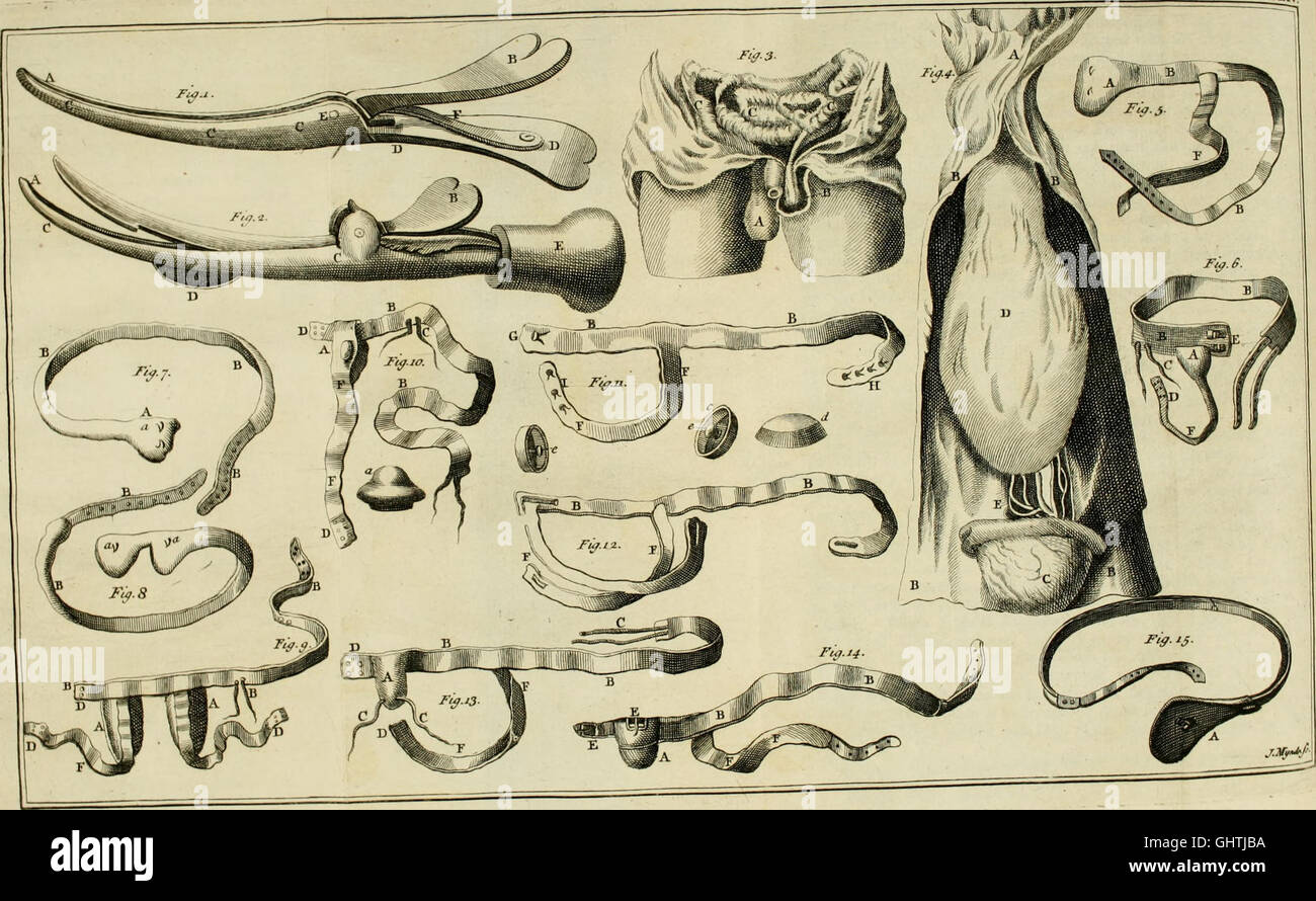 A comprehensive system of surgery in three parts, outlining the ...