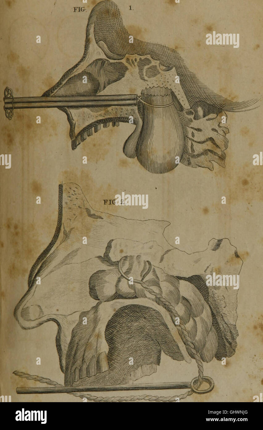 This 1804 volume provides a comprehensive overview of surgical ...