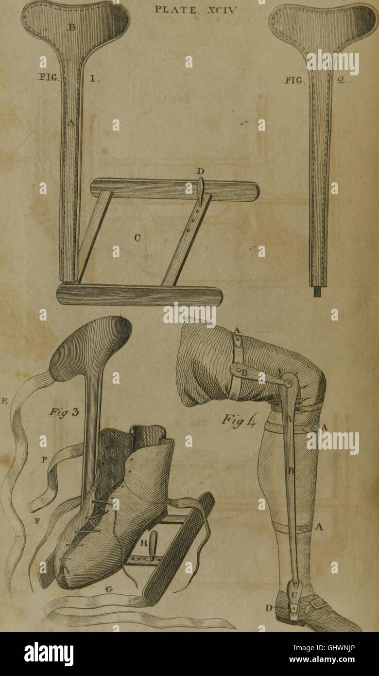 Volume 4 of a 1804 work on surgery, presenting advanced surgical ...