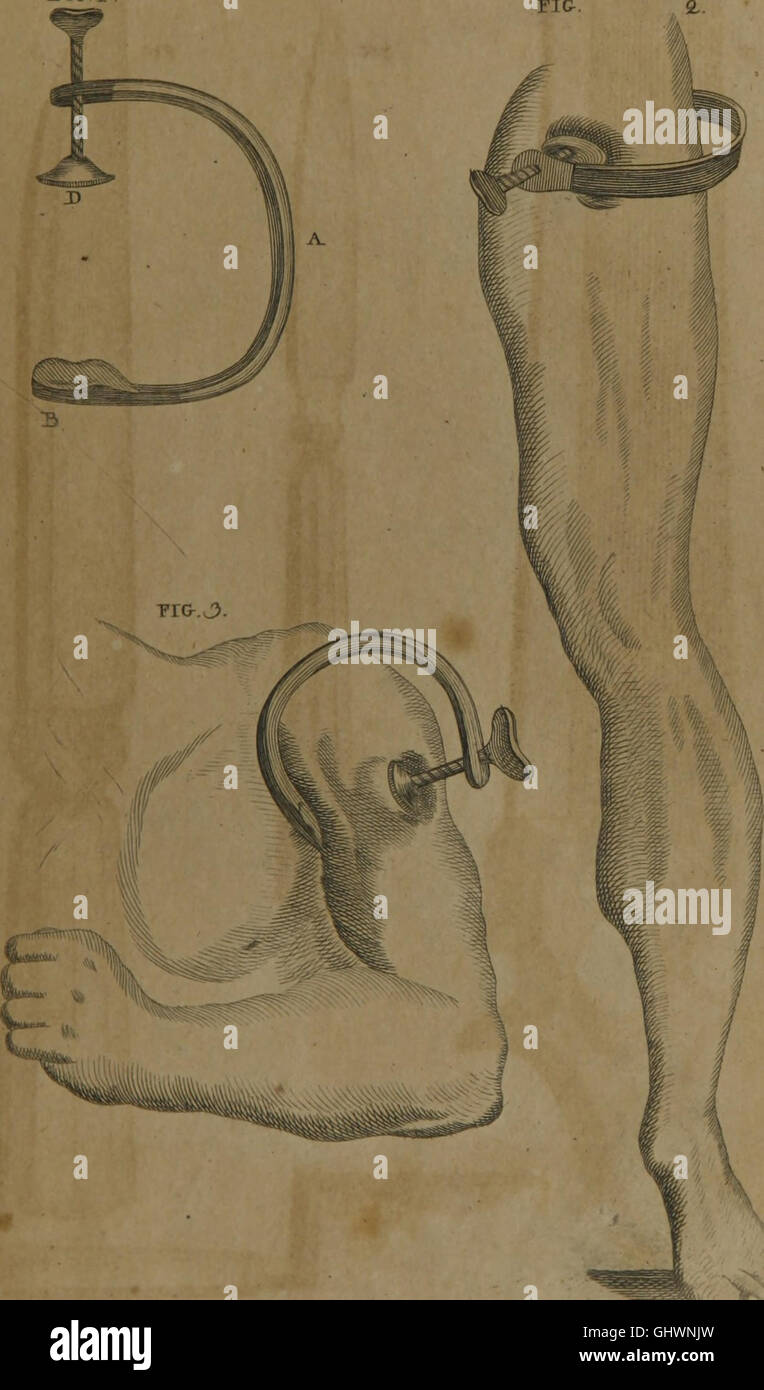 Volume 4 of this 1804 surgical text provides comprehensive insights ...