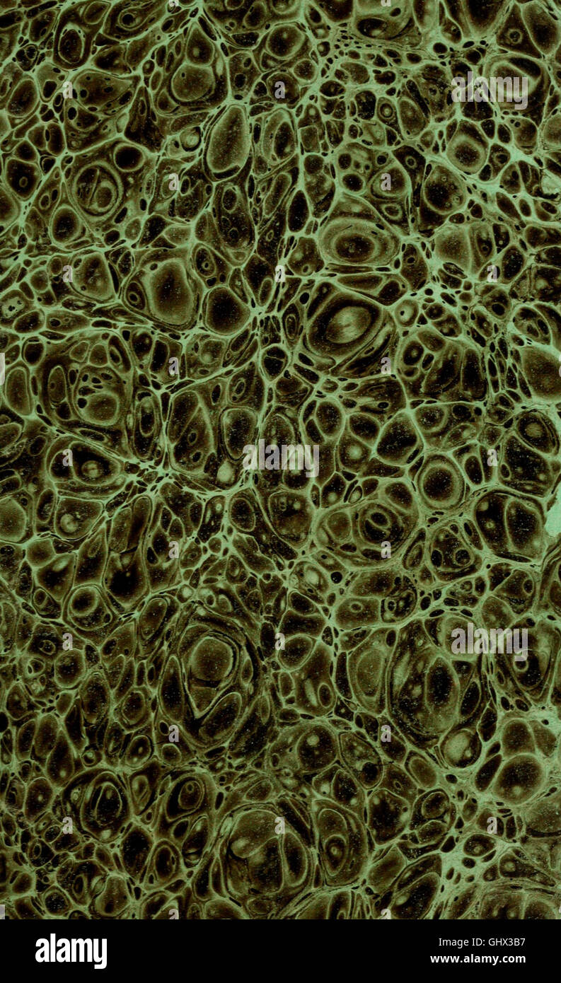 This 1860 work combines the historical siege of Granada with fictional ...