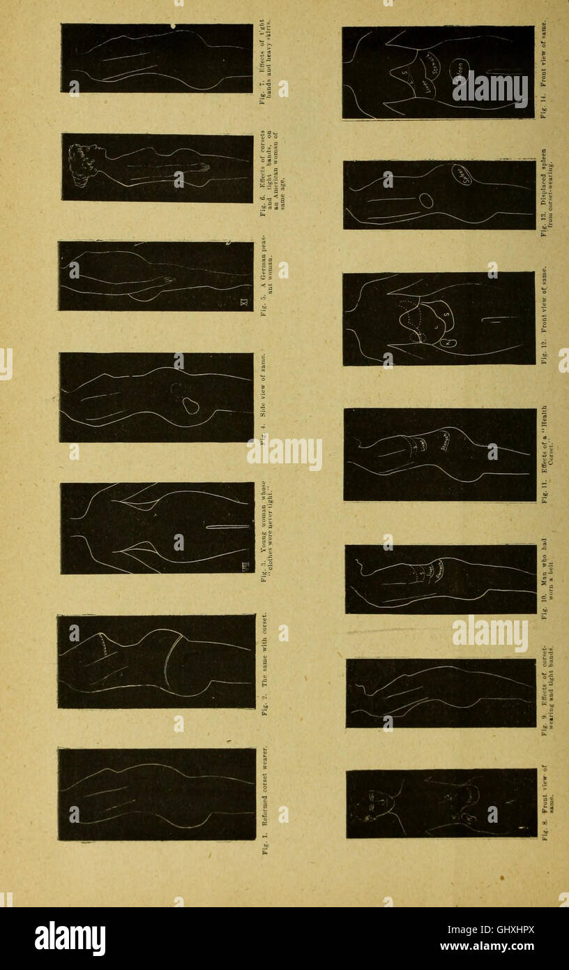 A 1894 review of modern medicine and bacteriology, examining the latest ...