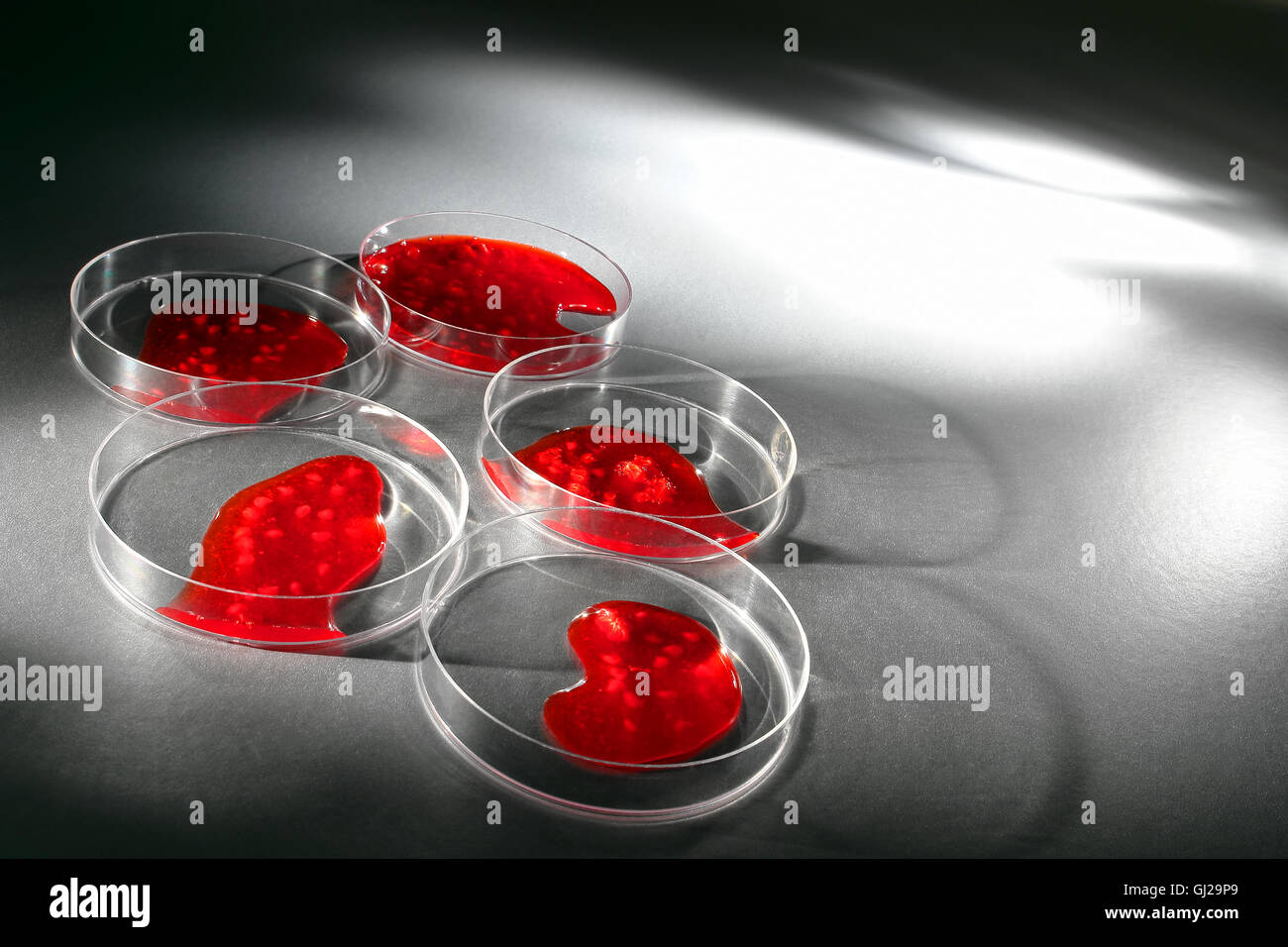 Petri Dish Bacteria Experiment