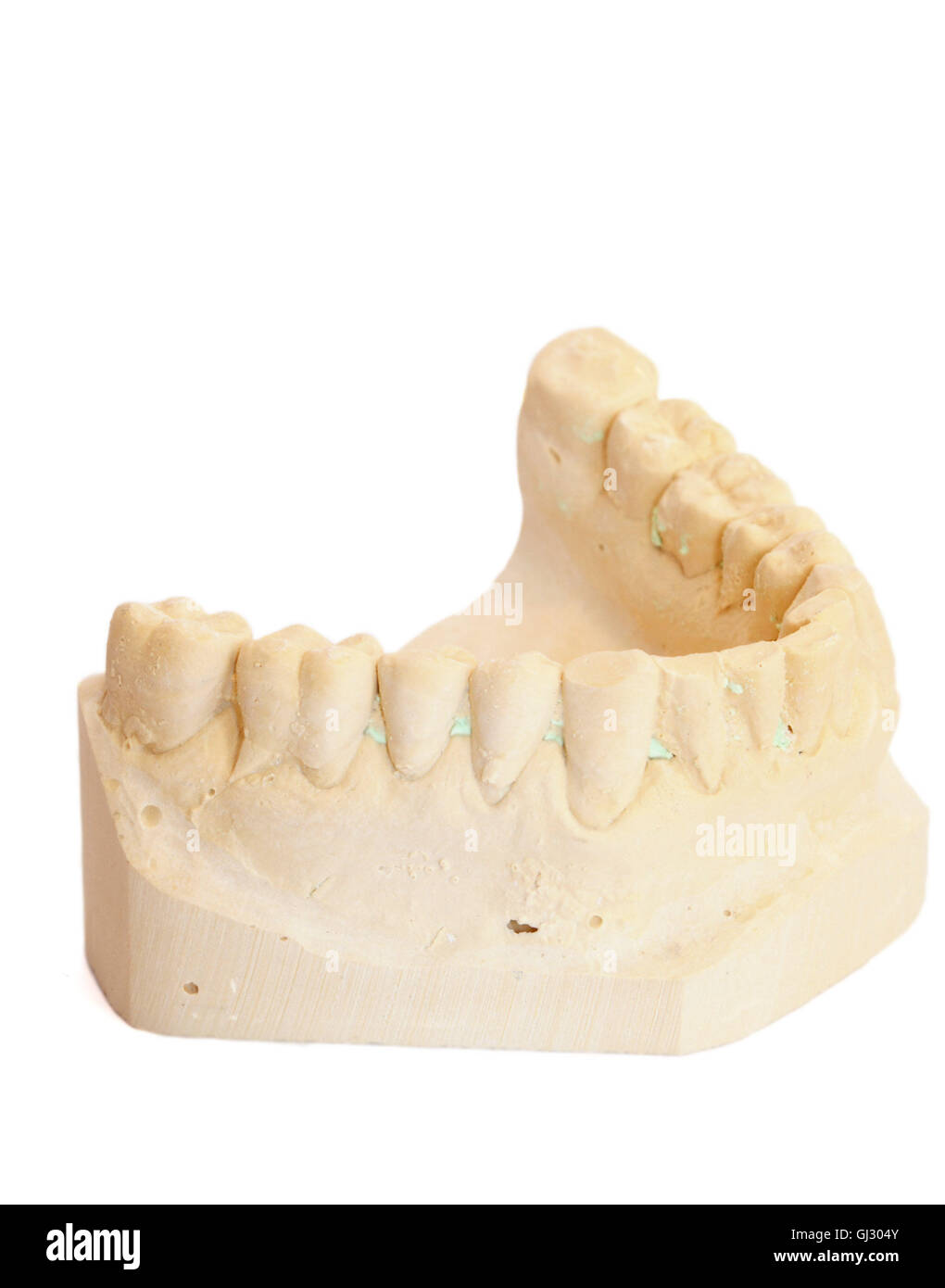Dental model jaw isolated hi-res stock photography and images - Alamy