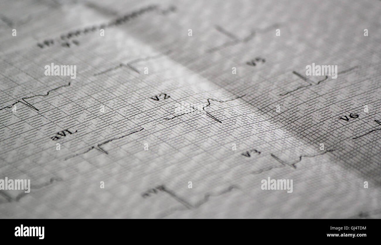Electro cardio gram hi-res stock photography and images - Alamy