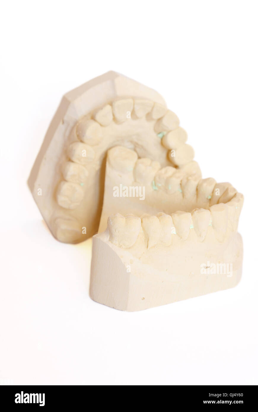 Dental impression Cut Out Stock Images & Pictures - Alamy