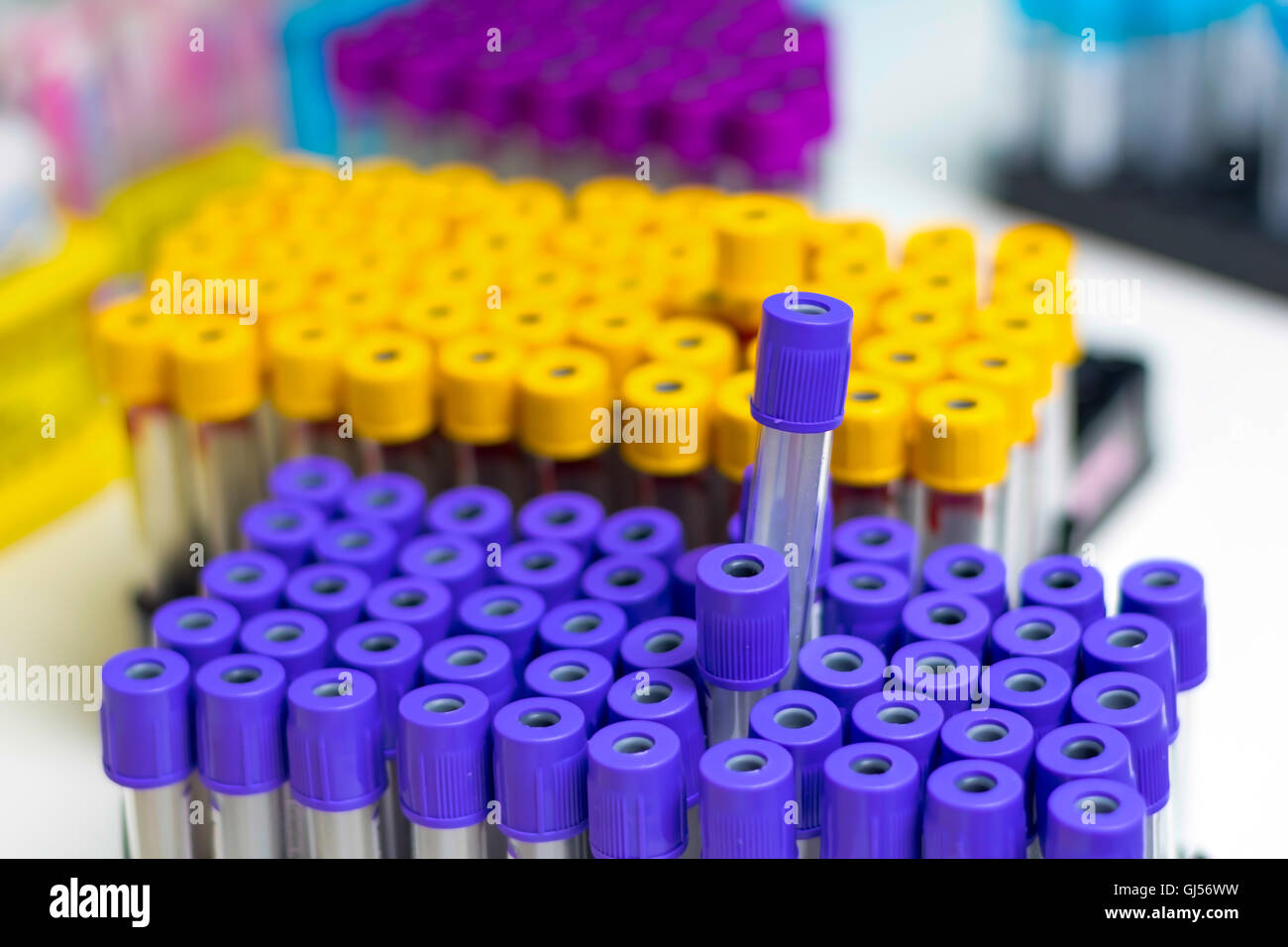 Blood specimen tubes on the tray Stock Photo - Alamy