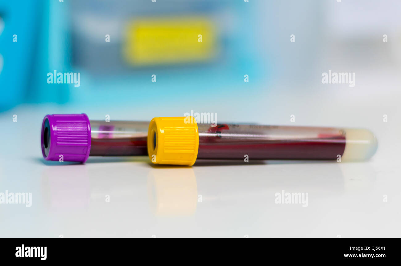 Sample image of macro photography hi-res stock photography and images ...