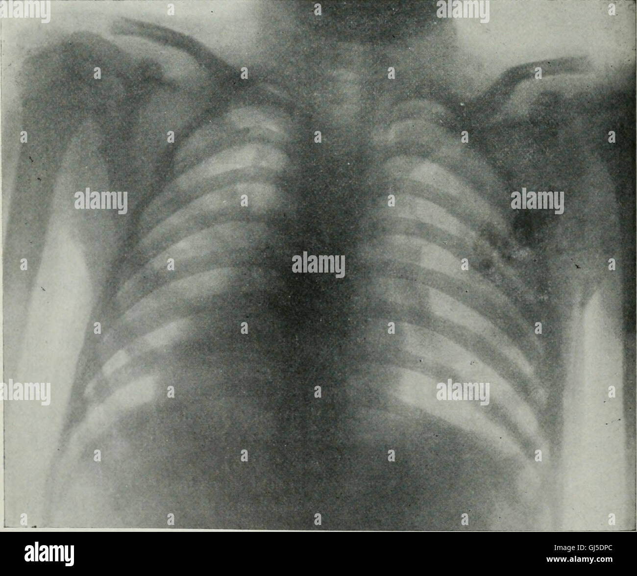 This 1903 work explores the use of X-rays (Roentgen rays) in medical ...