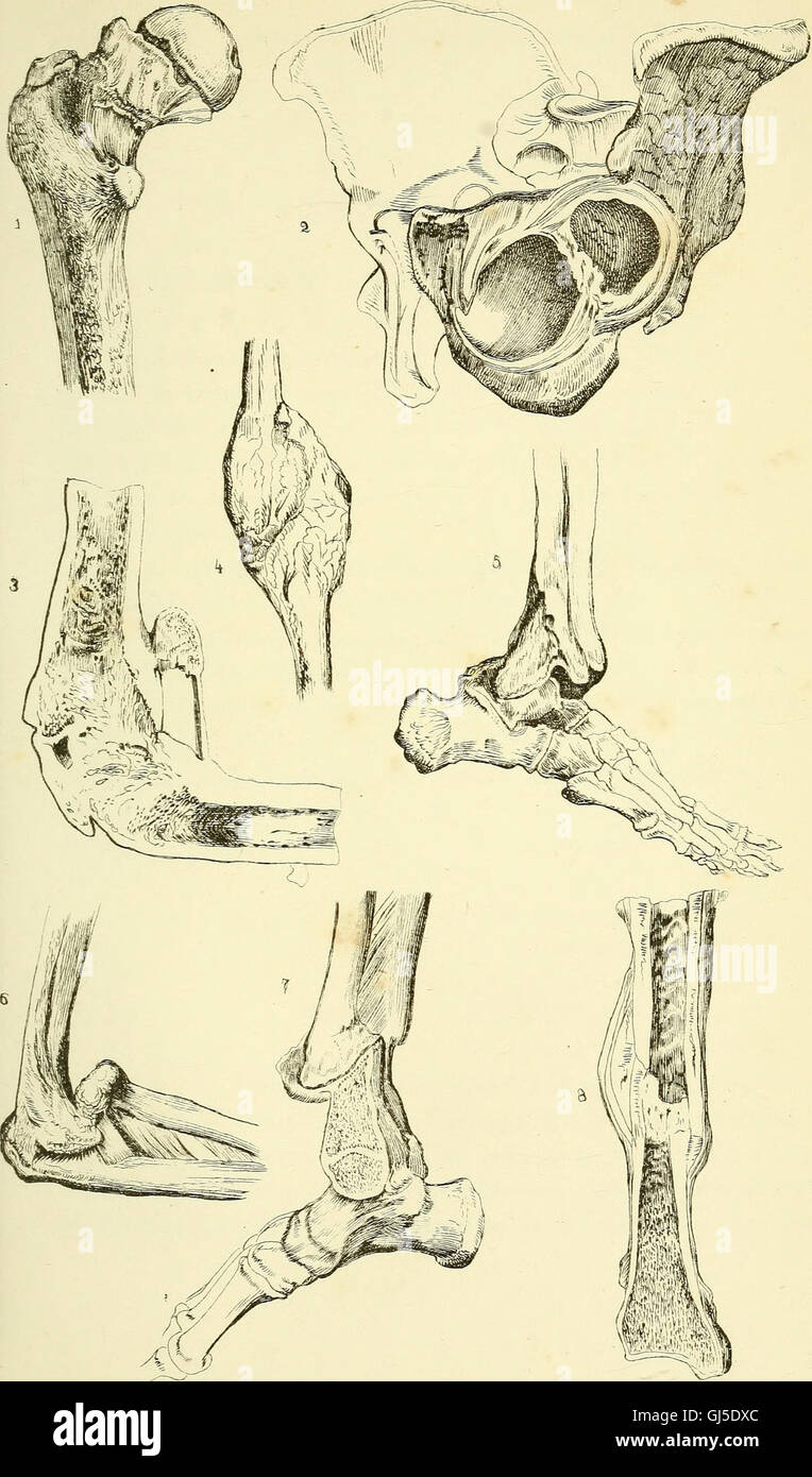 This 1852 work is a comprehensive guide to operative surgery, featuring ...