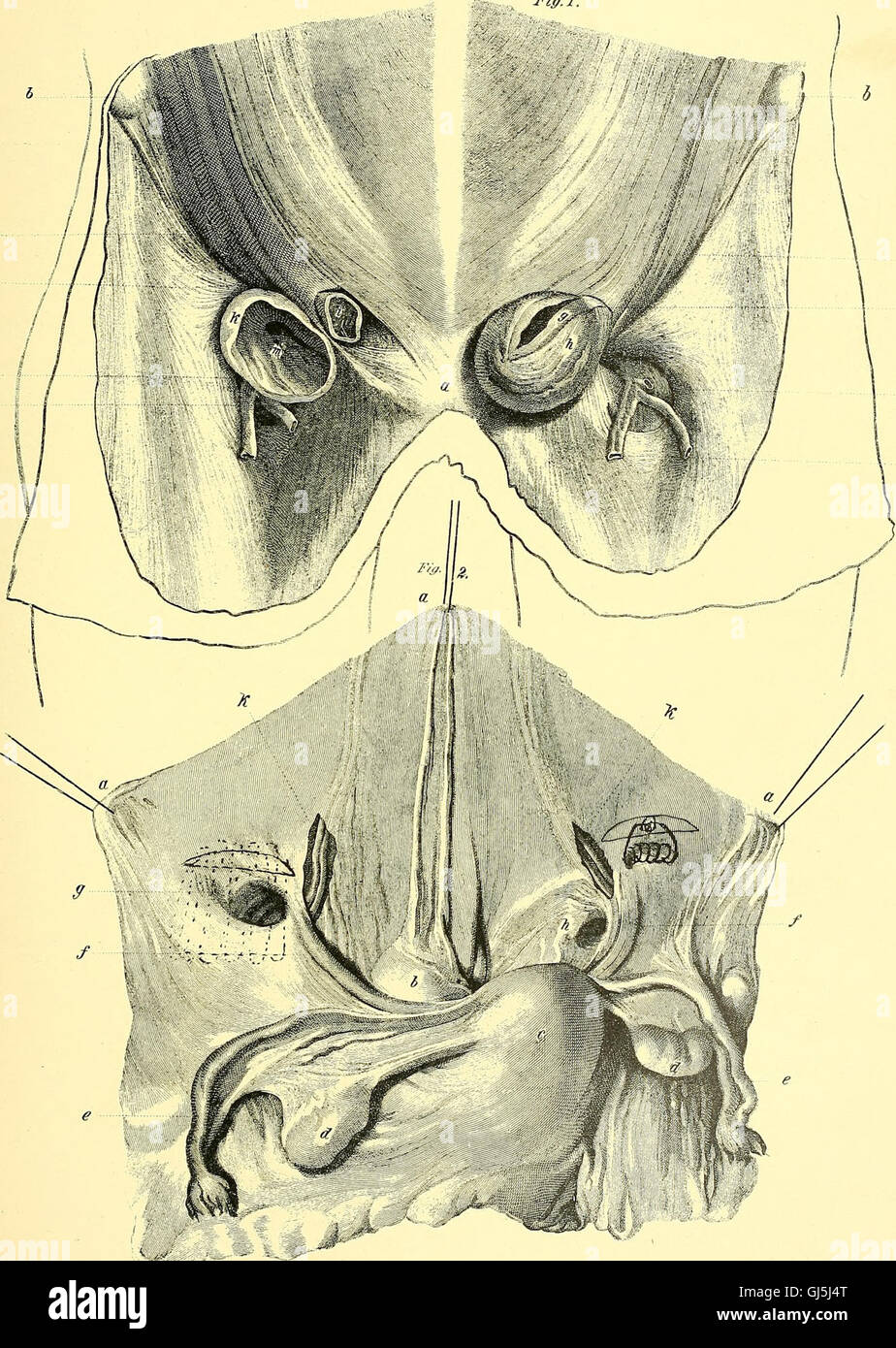 'The Anatomy and Surgical Treatment of Hernia' (1892) provides detailed ...